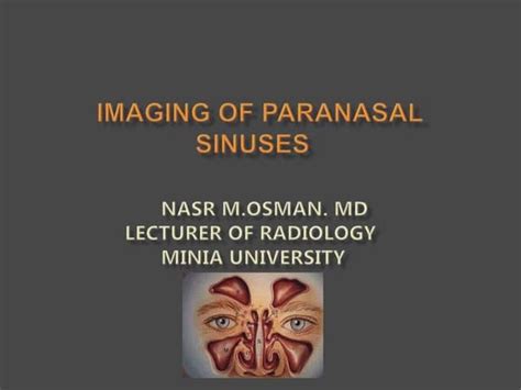 Surgical Anatomy Of Osteomeatal Complex Pptx