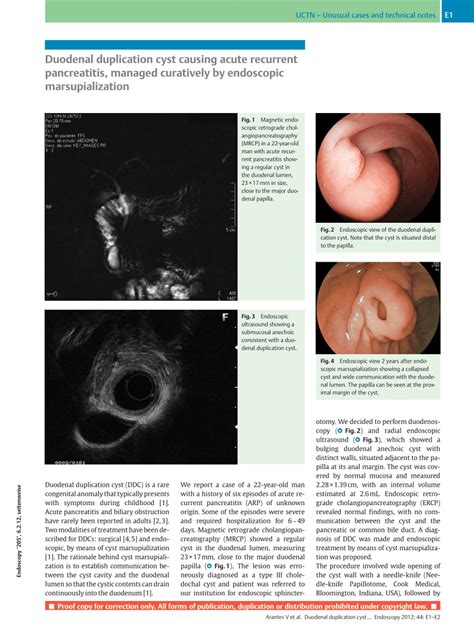 Pdf Duodenal Duplication Cyst Causing Acute Recurrent Pancreatitis