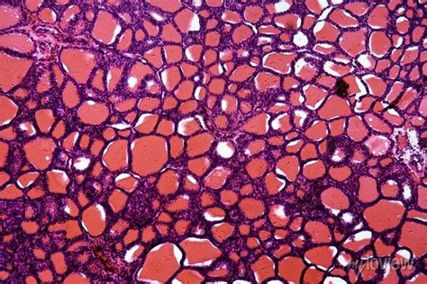 Thyroid Gland Cells Under The Microscope Canvas Prints For The Wall