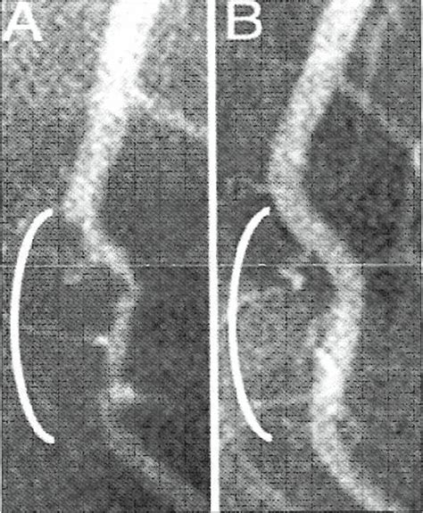 Wellness Program Incentives The Complete Guide