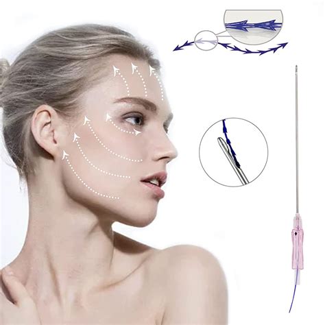 Pdo Molding Cog Thread Molded Type Barbed Suture For Face Body