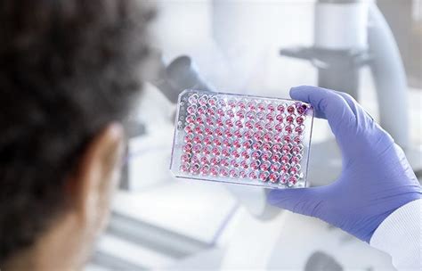 High Throughput Assays With Permeable Membrane Inserts Faten Deeb