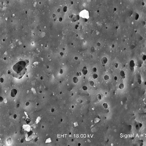 Sem Image Of The Apical Part After The Root Canal Preparation Of The