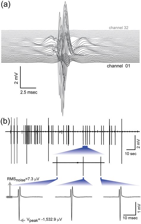 High Resolution Emg Recordings With Micro Cone Meas A Example