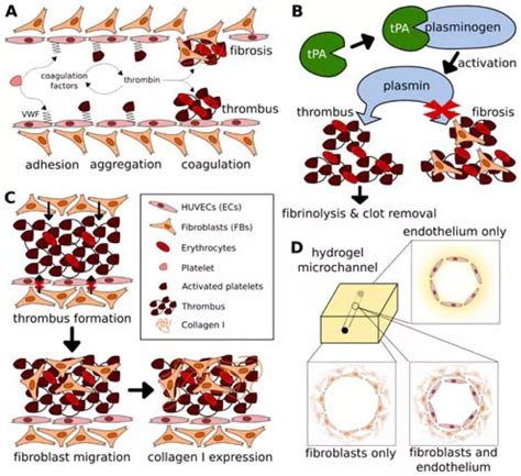 血管纤维化研究突破 3d打印高度仿生的血栓 芯片模型通道