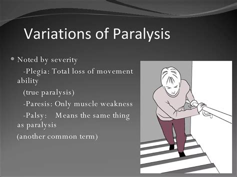 Paralysis Ppt
