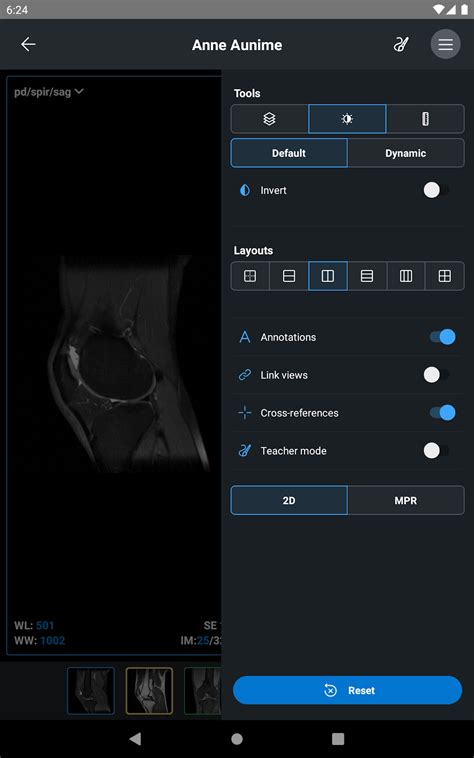 idv imaios dicom viewer apk for android download