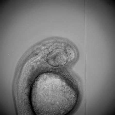 Using Light Sheet Fluorescence Microscopy To Image Zebrafish Eye