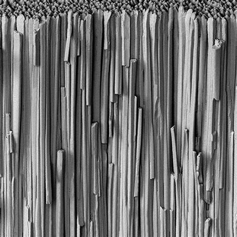 Digital Radiography And Pacs