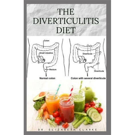 Diverticulitis Supplements