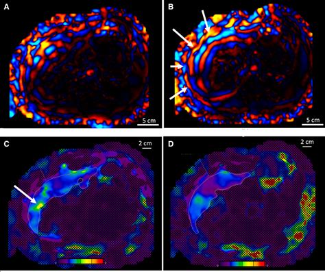 A Comparison Of The Wave Propagation In The Liver Using The