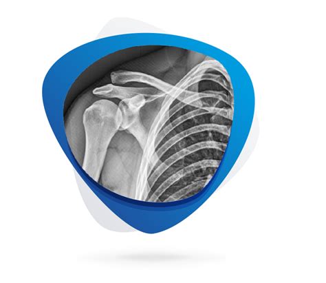 Bone Defect And Bone Repair Studies Pharmalegacy Preclinical