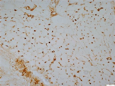 Cryptococcus Cryptococcus