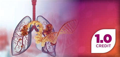 Nccn Guideline Update Ovarian Cancer Recommendations Version 3 2025