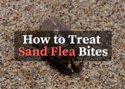 How To Treat Sand Flea Bites