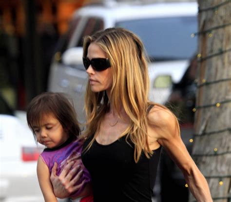 Denise Richards Scary Skinny Arms Raise Cause For Concern — But