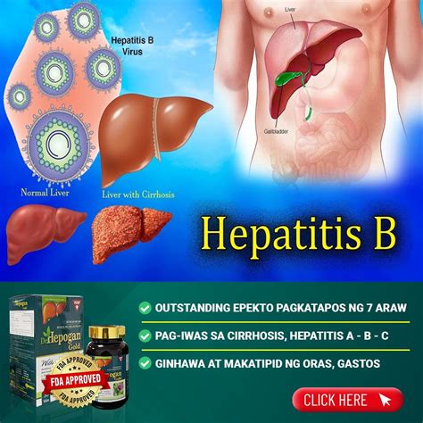 📢mga Gamot Para Sa Hepatitis Dr Hepogan Gold Philippines Facebook