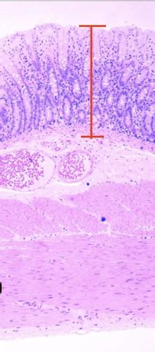 Lab 3 Digestive System Histology Flashcards Quizlet