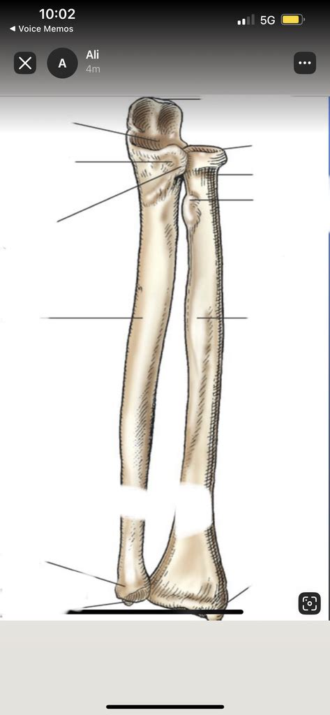 Anterior Forearm Labeling Diagram Quizlet