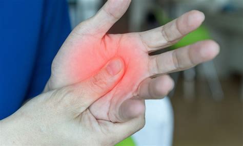 Trigger Finger Release Surgery Procedure Benefits And Recovery Dr Donald A Graham Md Frcsc