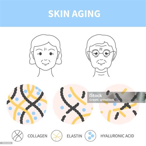 Female Skin Aging And Collagen Loss Diagram Illustration Stock