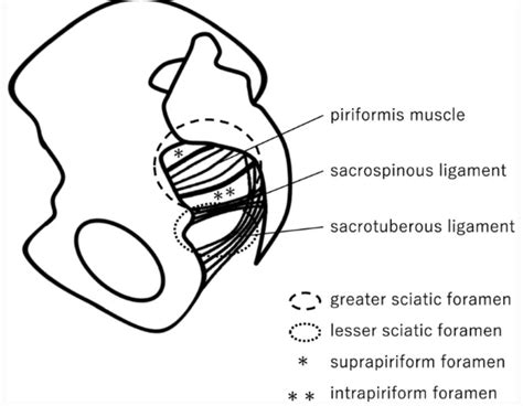 Sciatic Foramina