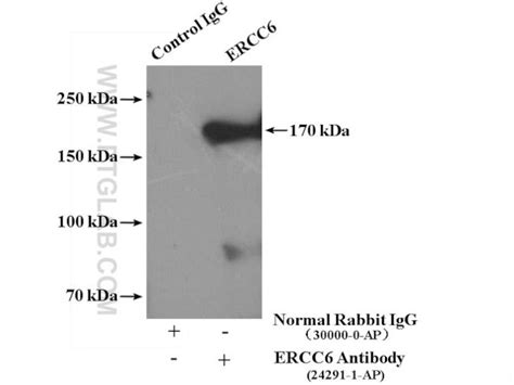 Ercc6csb Polyclonal Antibody 24291 1 Ap