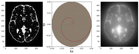 6 Non Cartesian Spiral Under Sampling — Mri Acquisition And Reconstruction