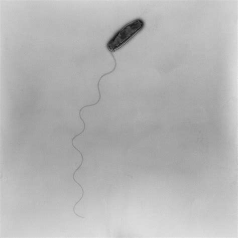 Negative Staining Faculty University Of Greifswald