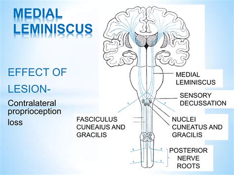 Brain Stem Lesions Pptx