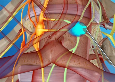 Treatments Specialist Pain Clinic