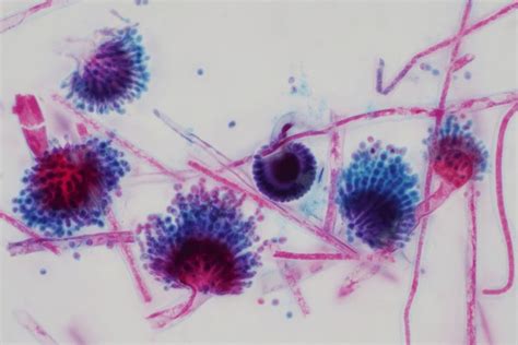 Aspergillus Microscope