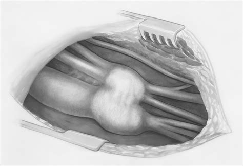Pelvic Floor Muscles Anatomy And Function