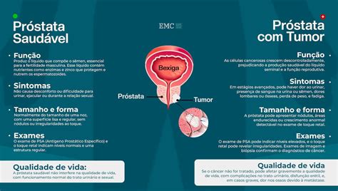 Vovo De Conscientizacao Sobre Cancer De Prostata Descobrir 61 Imagem