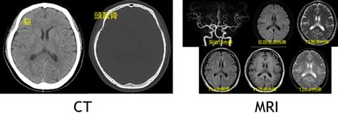 Mri と Ct どちらがいいか Mri Ct 違い わかりやすく Bvjz