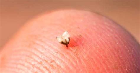 How To Identify 10 Of The Most Common Bug Bites