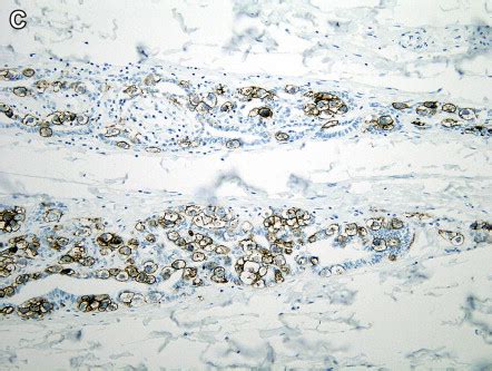 Disorders Of Sexual Differentiation Surgical Pathology Clinics