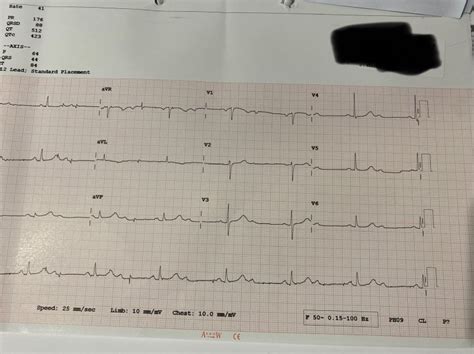 Moza Almatrushi On Linkedin What Do You See In This Ecg Is Normal Or Not