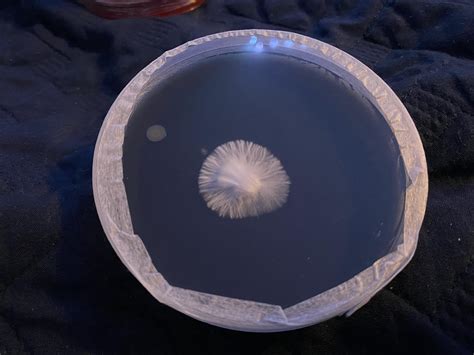 Looking At My Contaminated Agar Plates R Contamfam