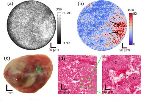 Figure 1 From Ultrahigh Resolution Optical Coherence Elastography Through A Micro Endoscope