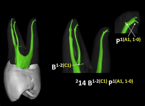 Tooth Root And Canal Anatomy Pocket Dentistry