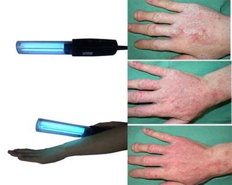 Philips Uvb Bulb At Rs 2700piece Philips Led T Bulb In Mumbai Id 2853049730497