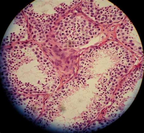 Interstitialtissue100xp5170444 David Fankhauser