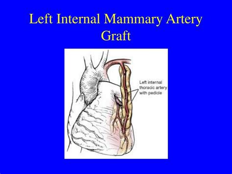 Ppt Ischaemic Heart Disease Powerpoint Presentation Id 816453