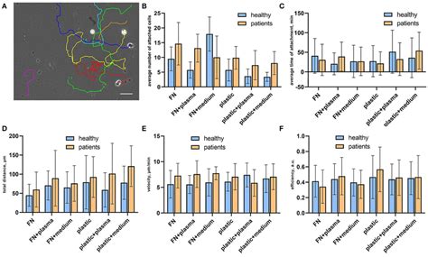 Random Migration Assay For Sorted Ctls A Representative Migration
