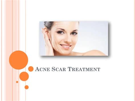 Ppt Acne Scar Treatment Options Powerpoint Presentation Free