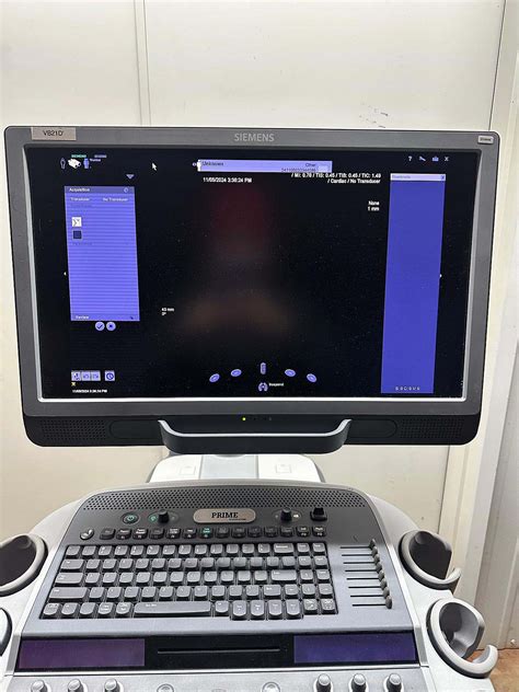 Acuson Sc2000 Siemens Ultrasound Machine Medsold