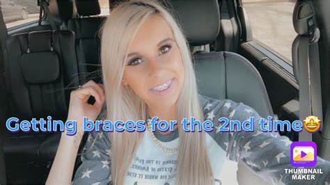 Getting Braces Again For The Second Time YouTube