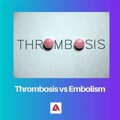Trombose X Embolia Diferença E Comparação