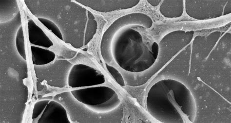 Neural Tissue Engineering Ibme